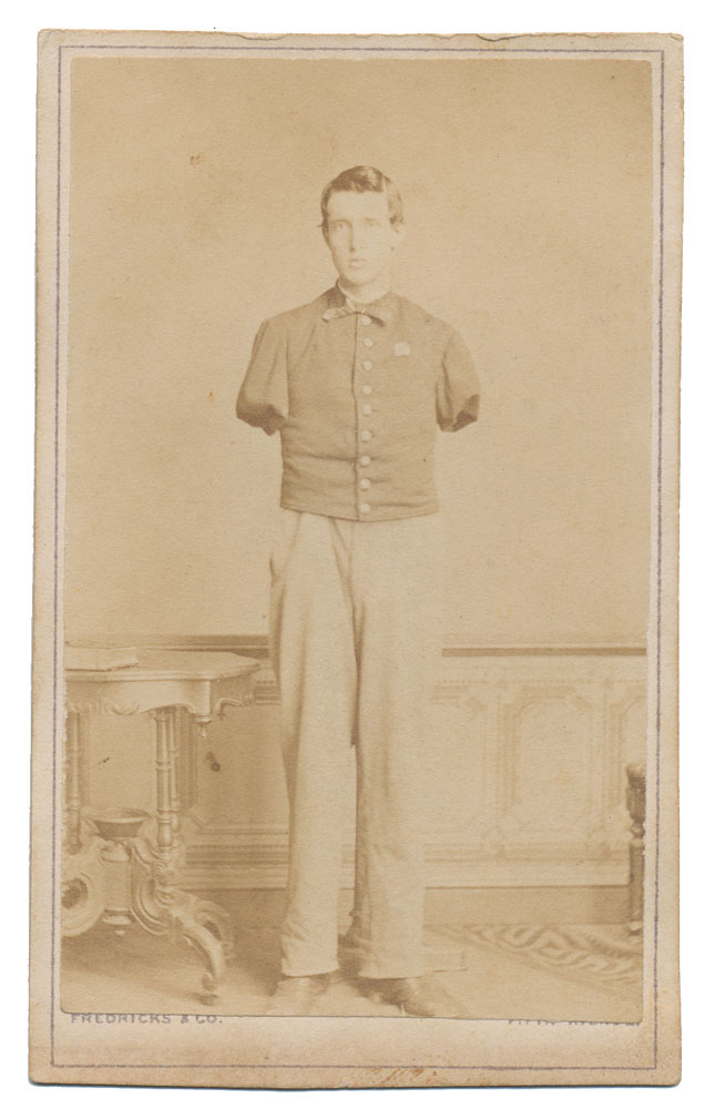 CDV OF FAMOUS 147TH NEW YORK DOUBLE AMPUTEE — Horse Soldier